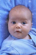 Edema Neonatal - Pages [1] - Conhecimento enciclopédico Mundo